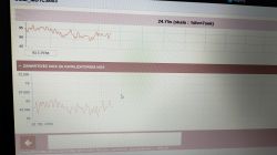 Citroen Berlingo 1.5hdi - Problem z SCR - AdBlue. Błąd P20EE 92 w ...